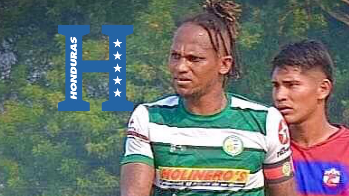 Georgie Welcome: “Hay que tenerle amor a la camiseta, sudarla y morir ...